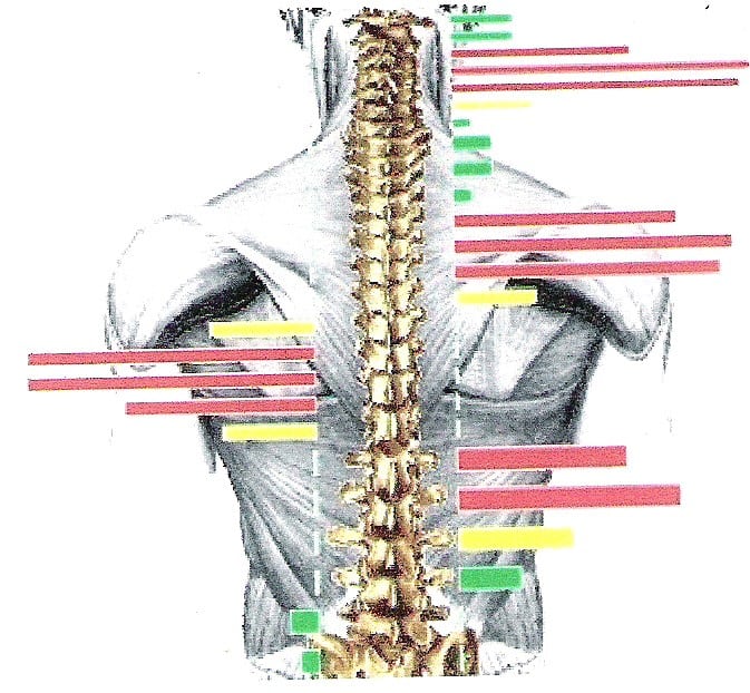 The Chiropractic Technique Parade | Science-Based Medicine