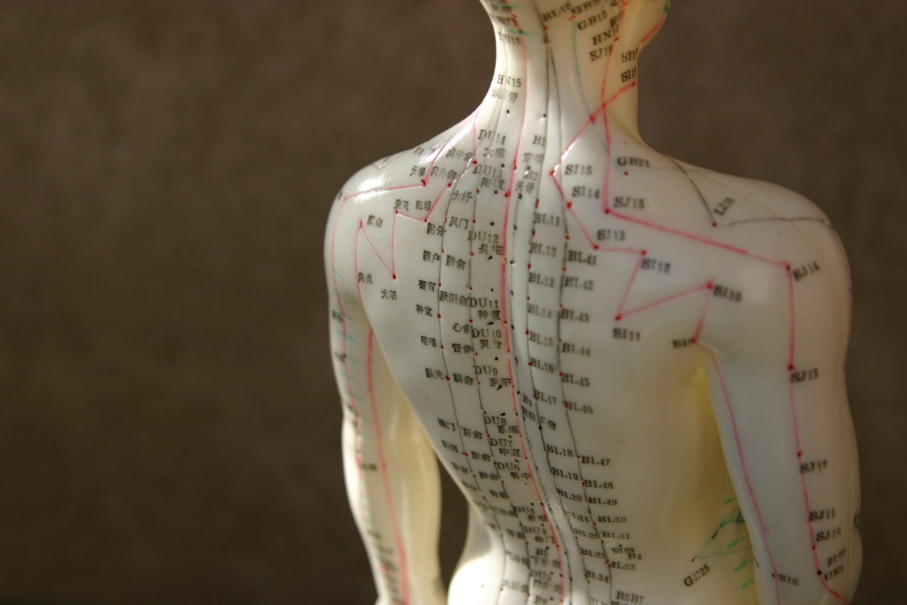 Acupuncture | Science-Based Medicine
