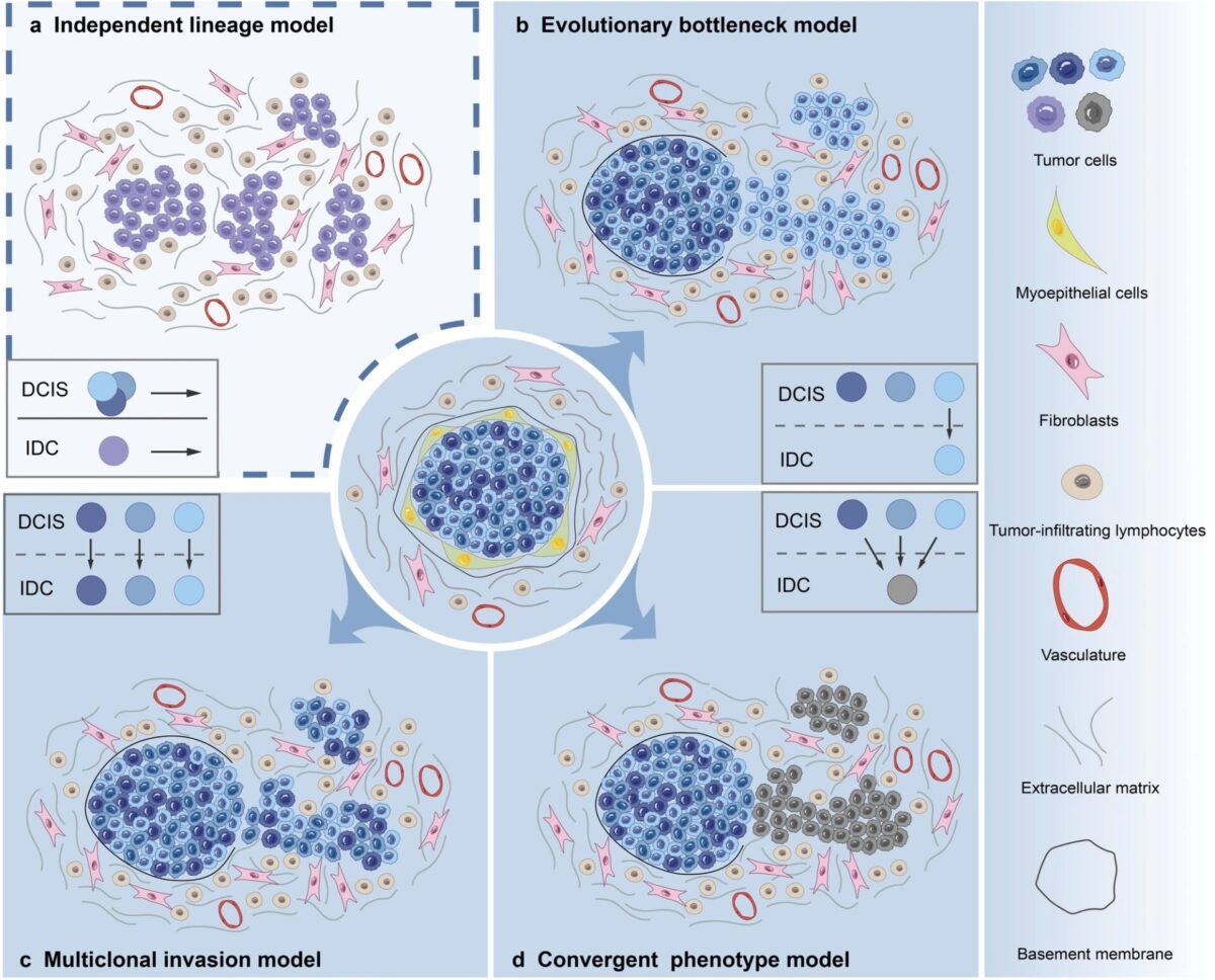 Is watchful waiting for ductal carcinoma in situ (DCIS) safe ...