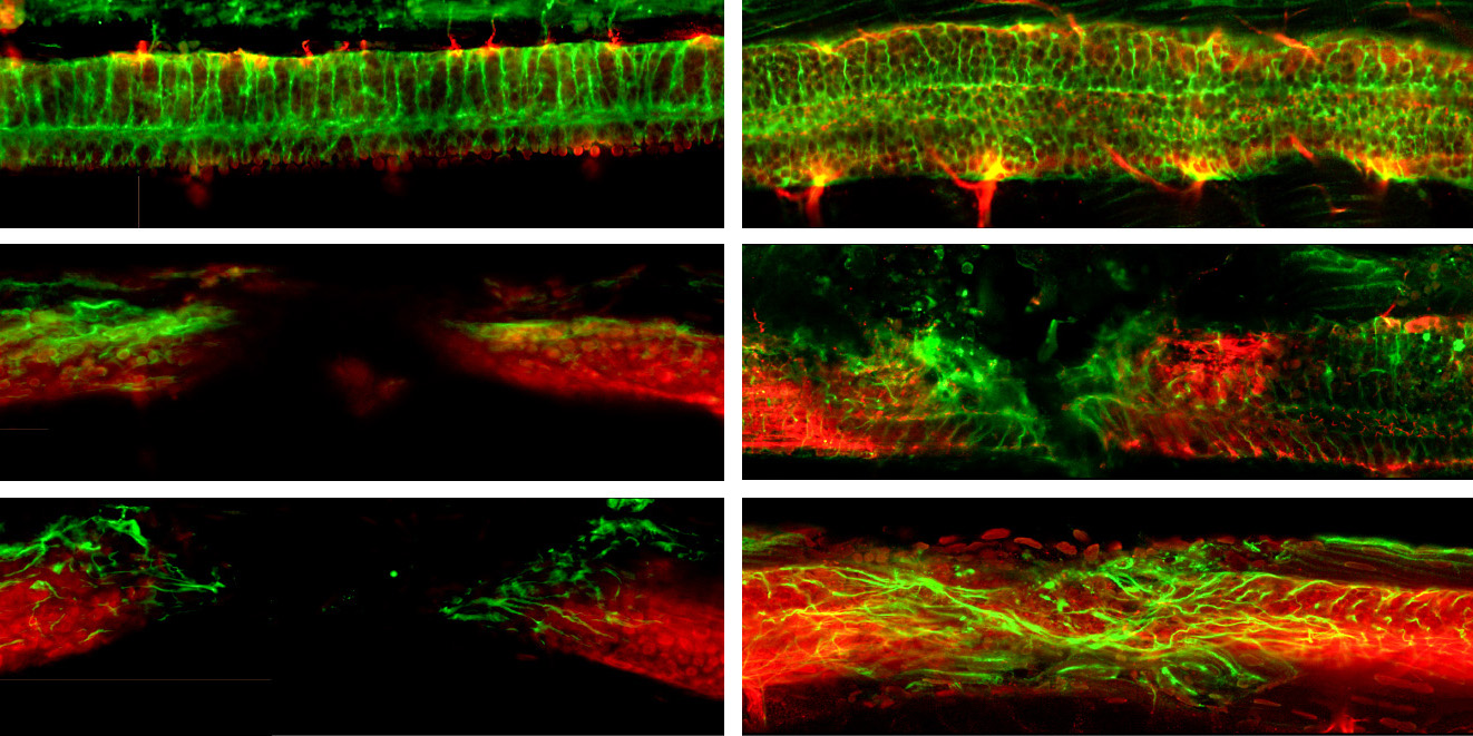 In Animal Study, Nanobots Repair Spinal Cords | Science-Based Medicine